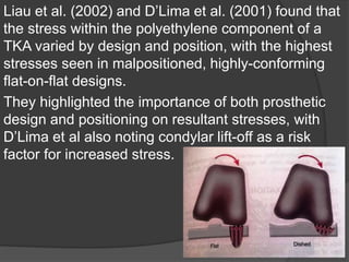 Alignment and fixation in total knee journal club.pptx
