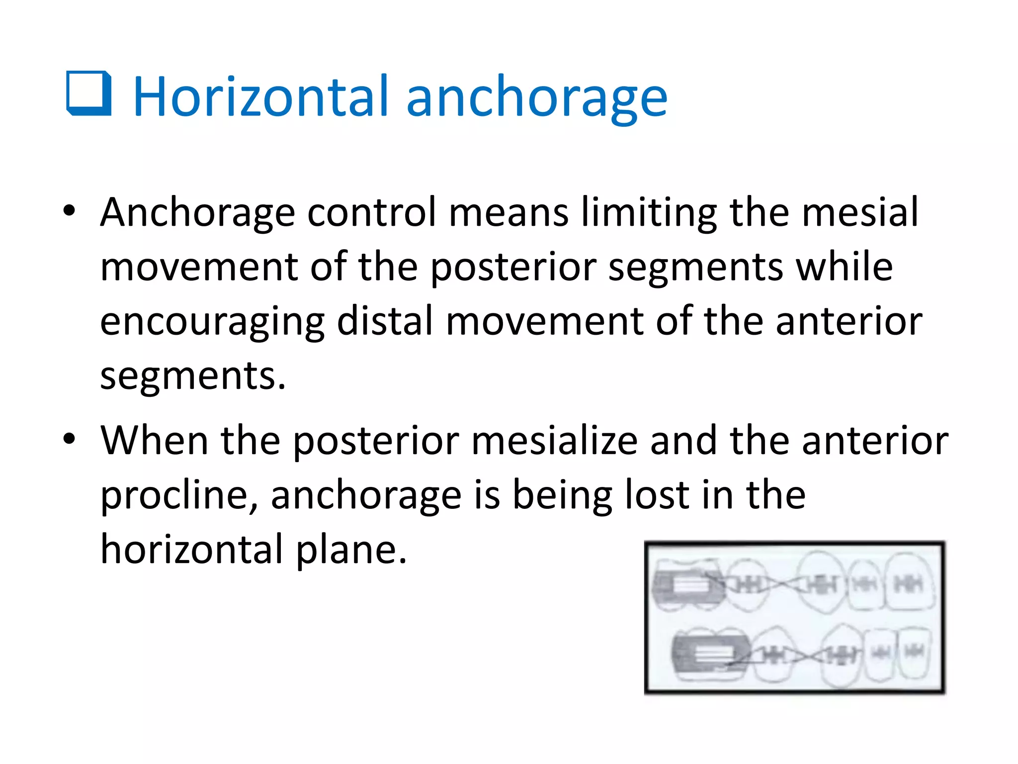 Alignment and leveling | PPTX