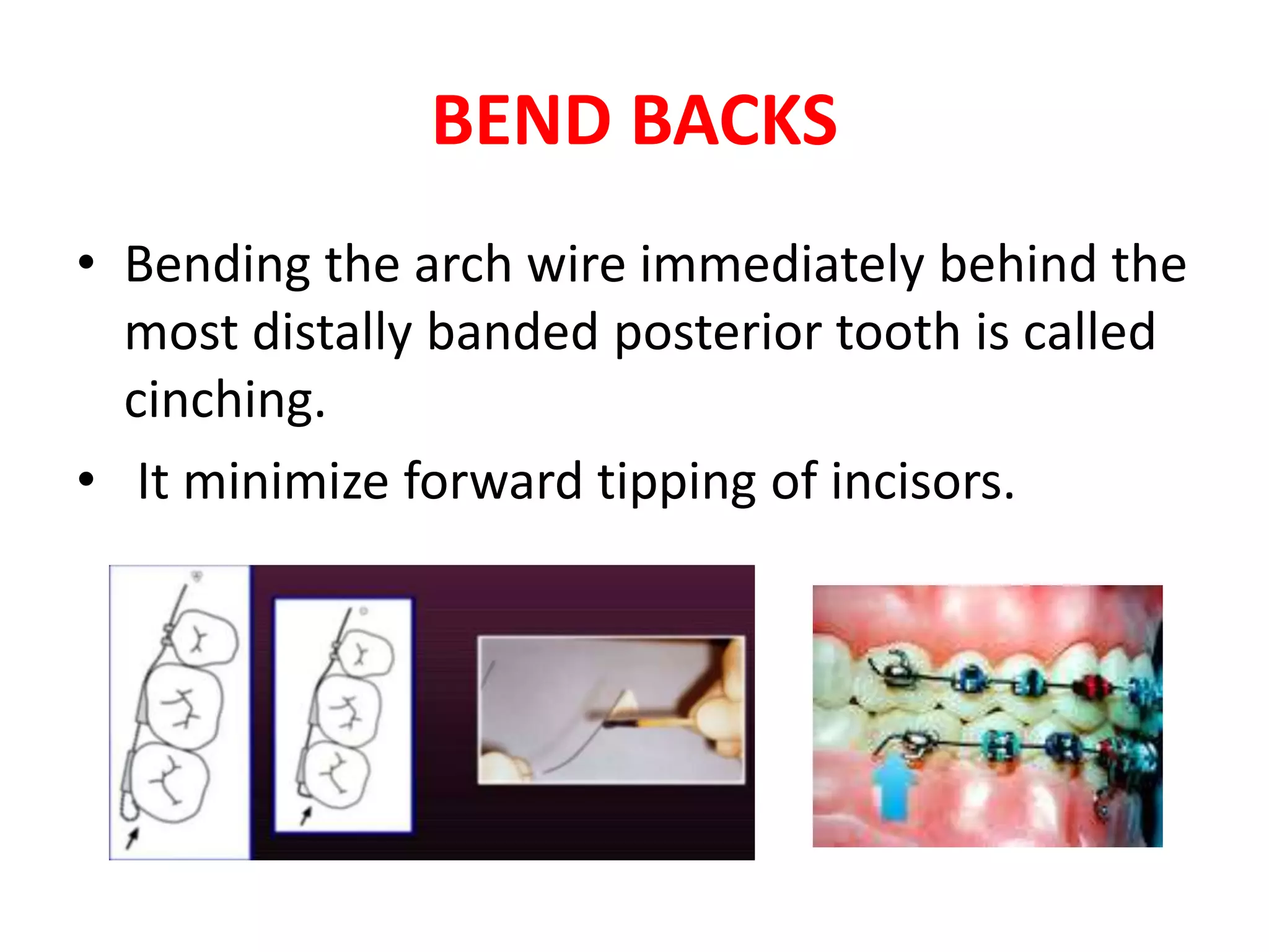 Alignment And Leveling Pptx