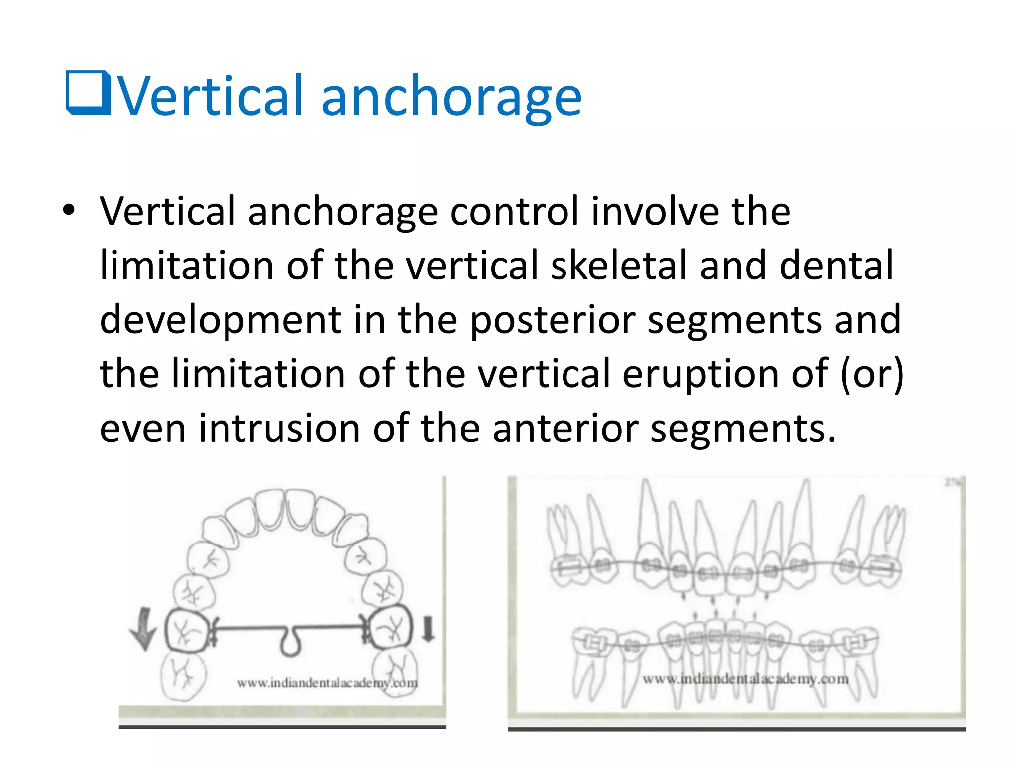 Alignment and leveling | PPTX