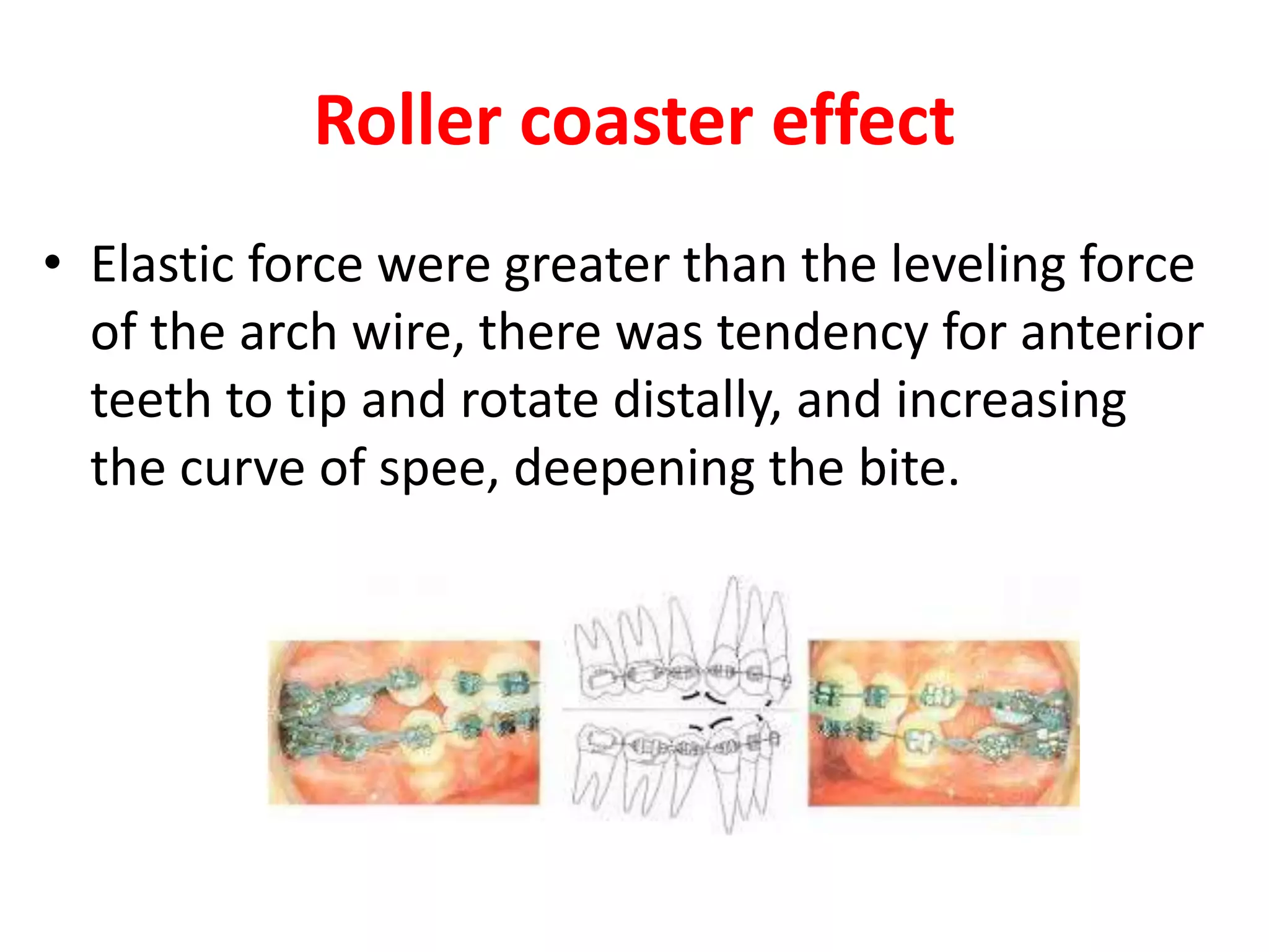 Alignment and leveling | PPTX