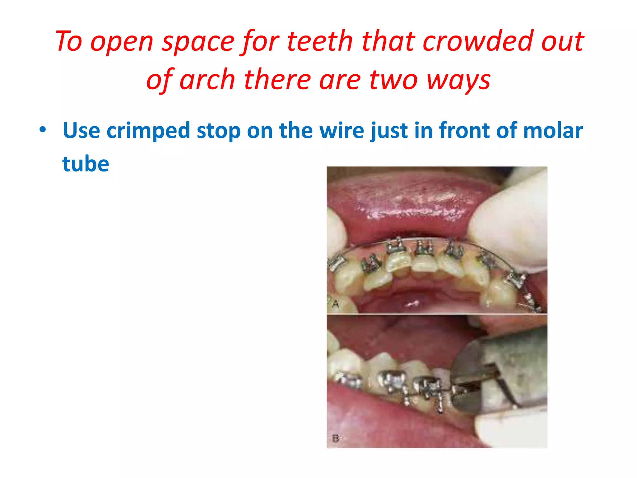 Alignment and leveling | PPTX