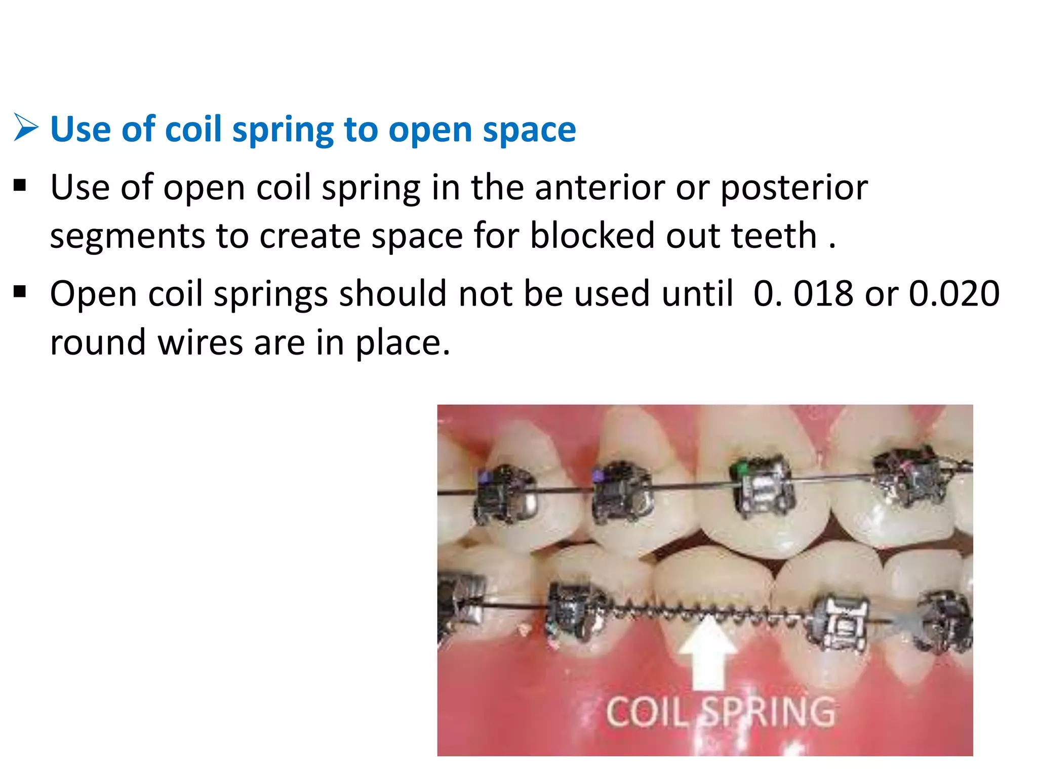 Alignment and leveling | PPTX
