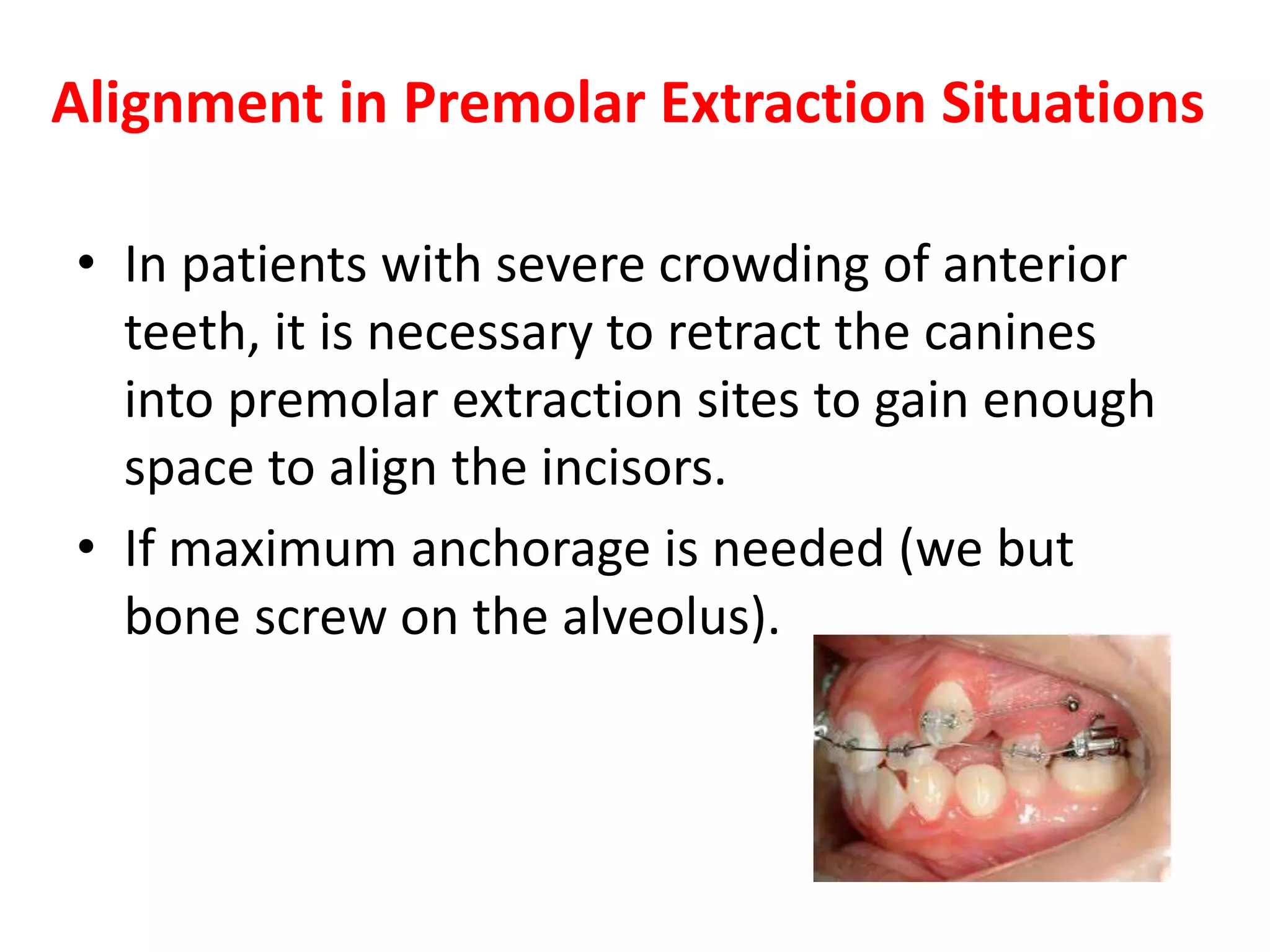 Alignment and leveling | PPTX