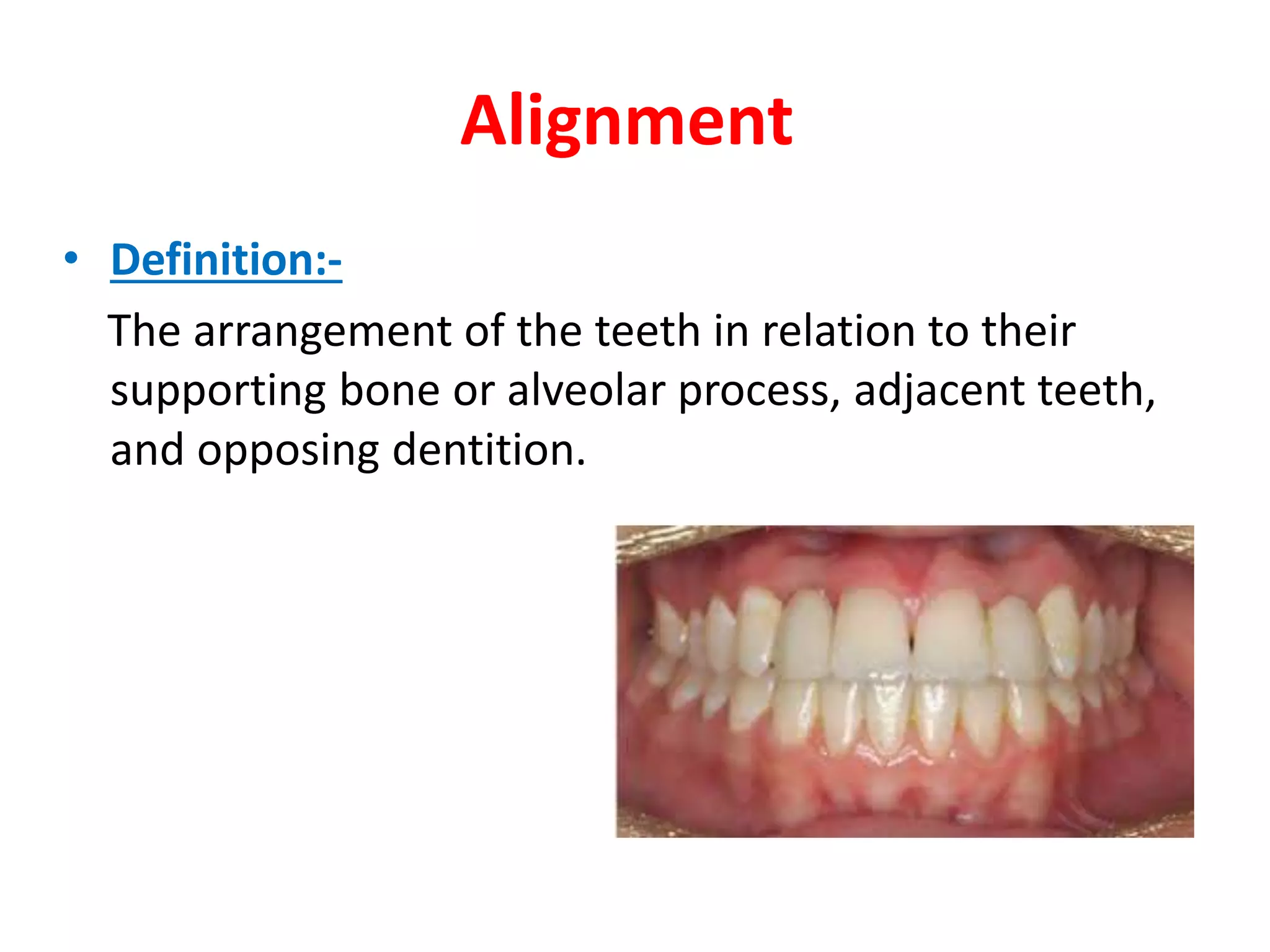 Alignment and leveling | PPTX