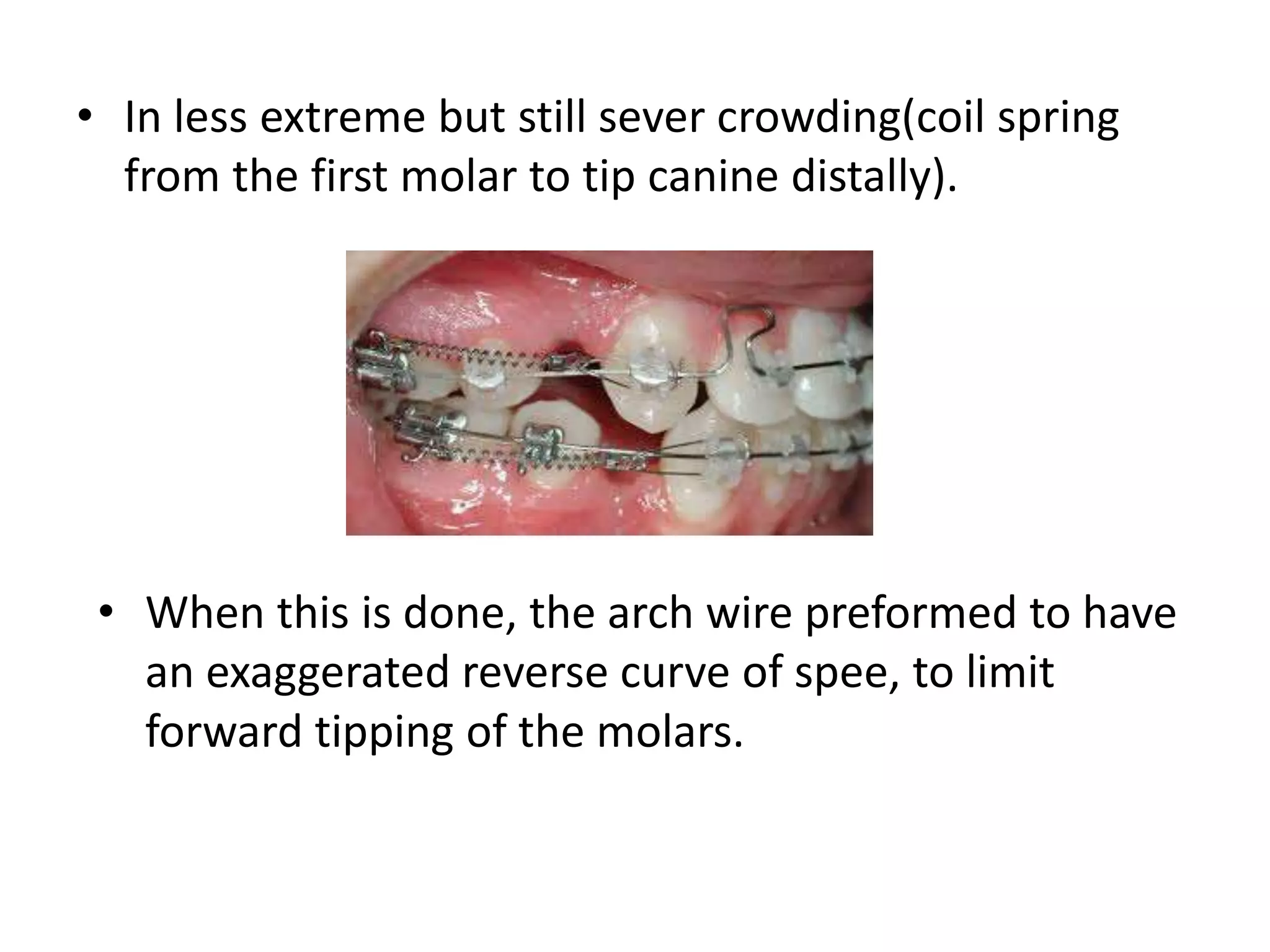 Alignment and leveling | PPTX