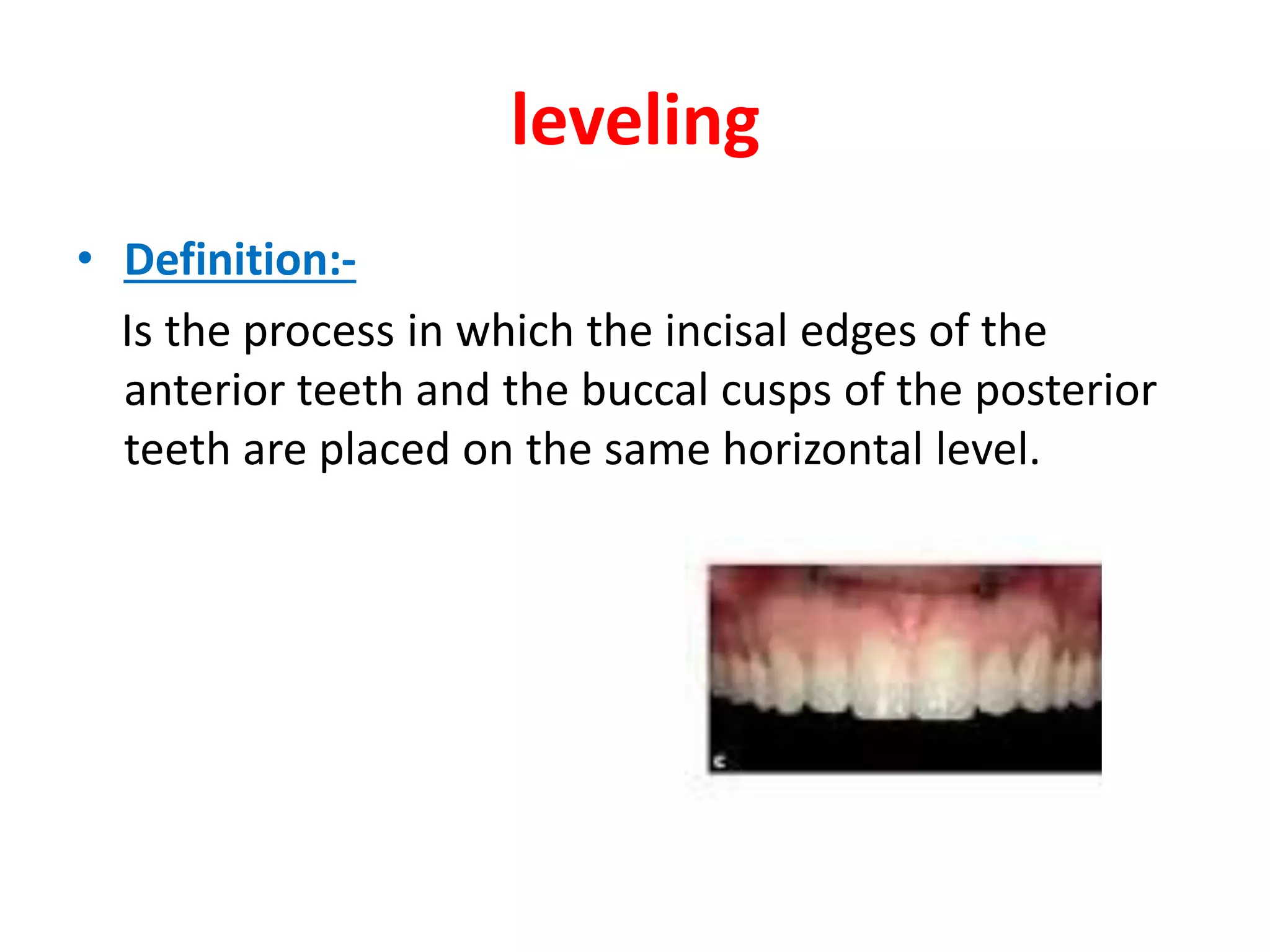Alignment and leveling | PPTX