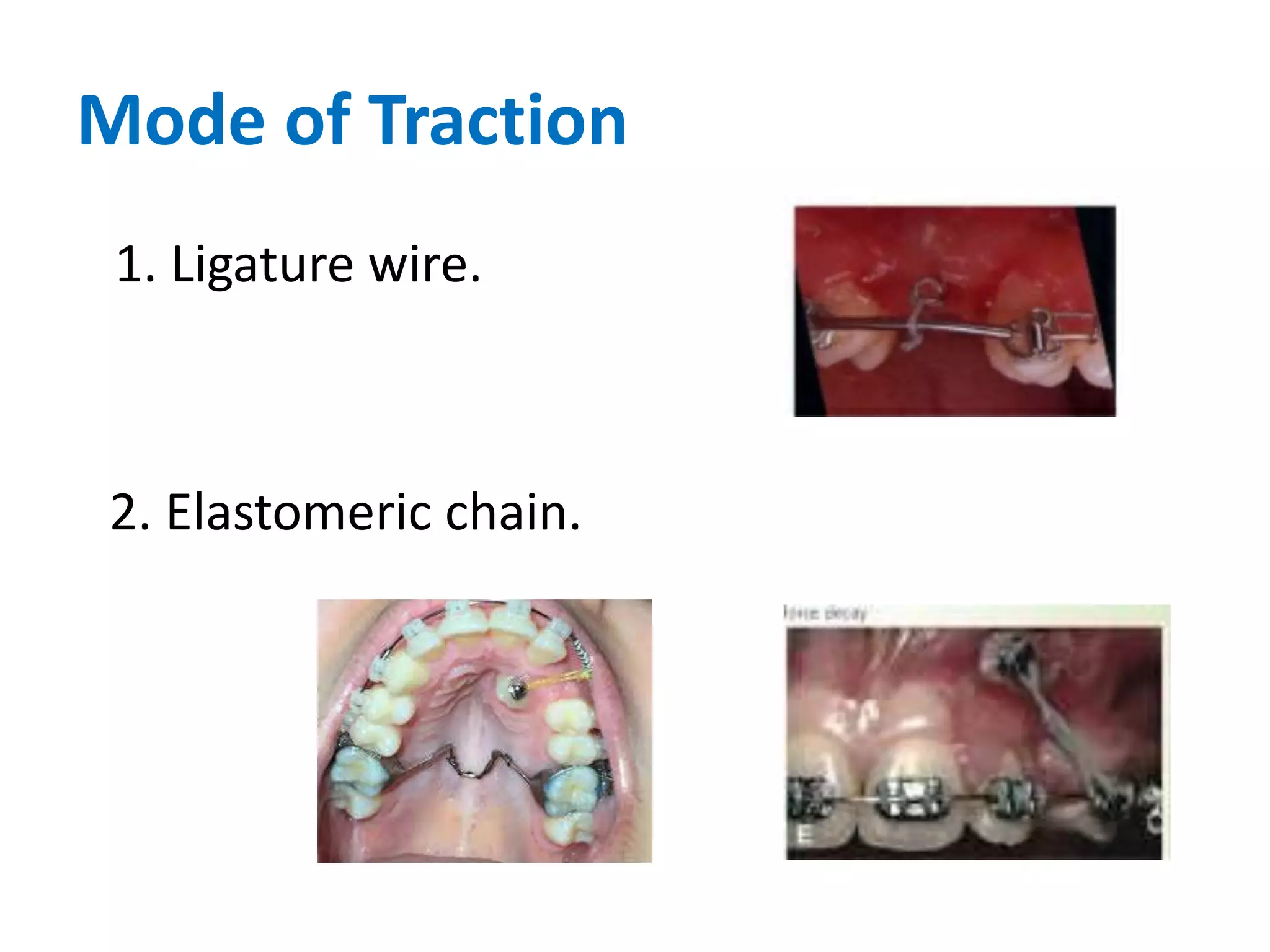 Alignment and leveling | PPTX
