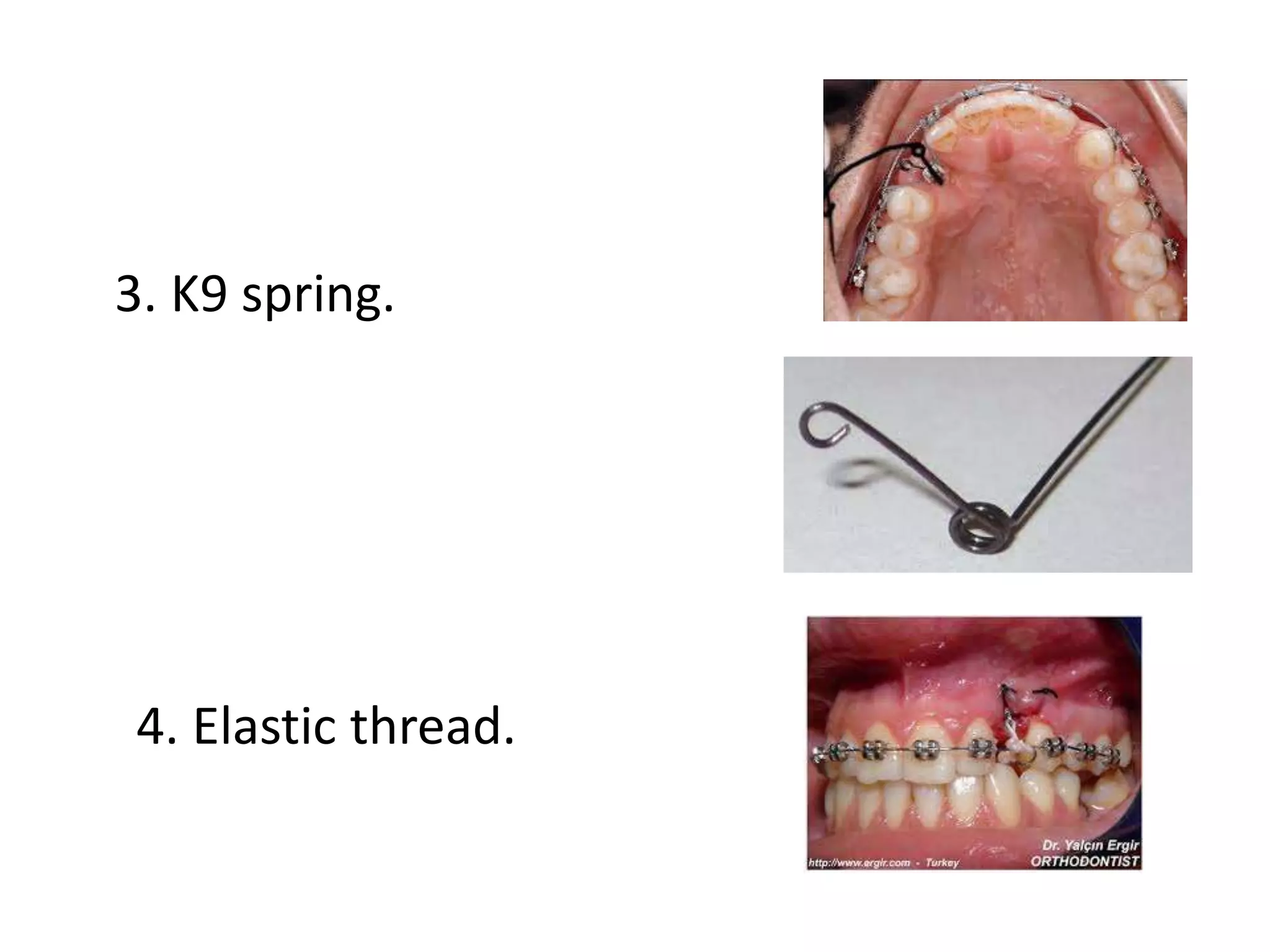 Alignment and leveling | PPTX