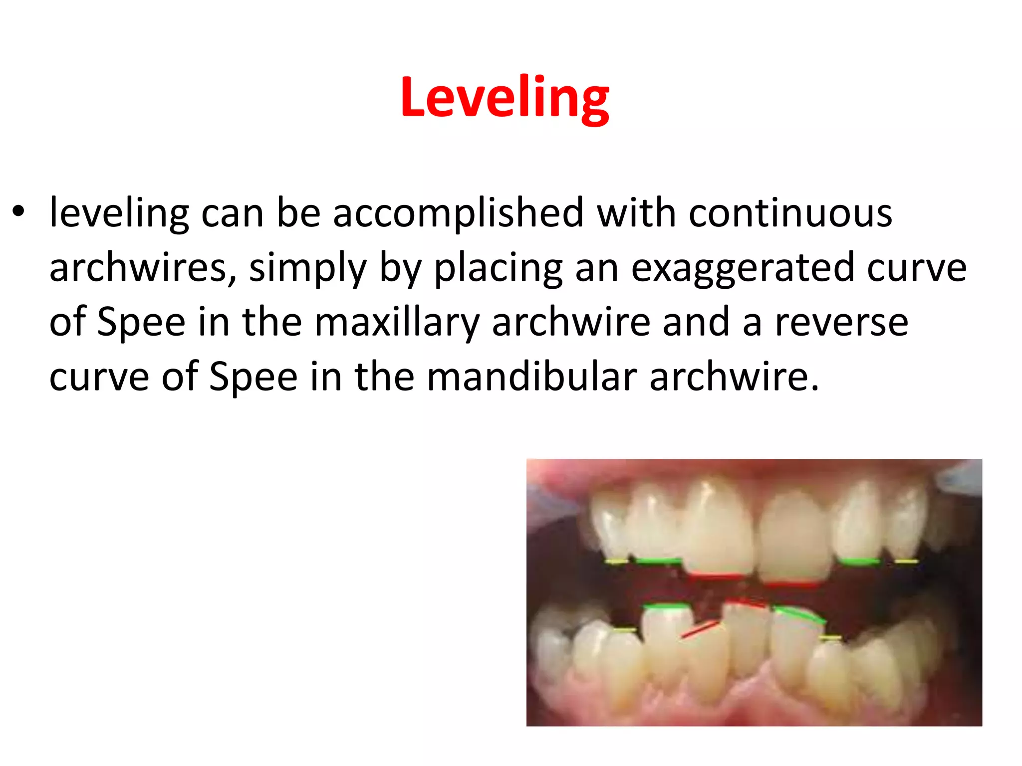 Alignment and leveling | PPTX