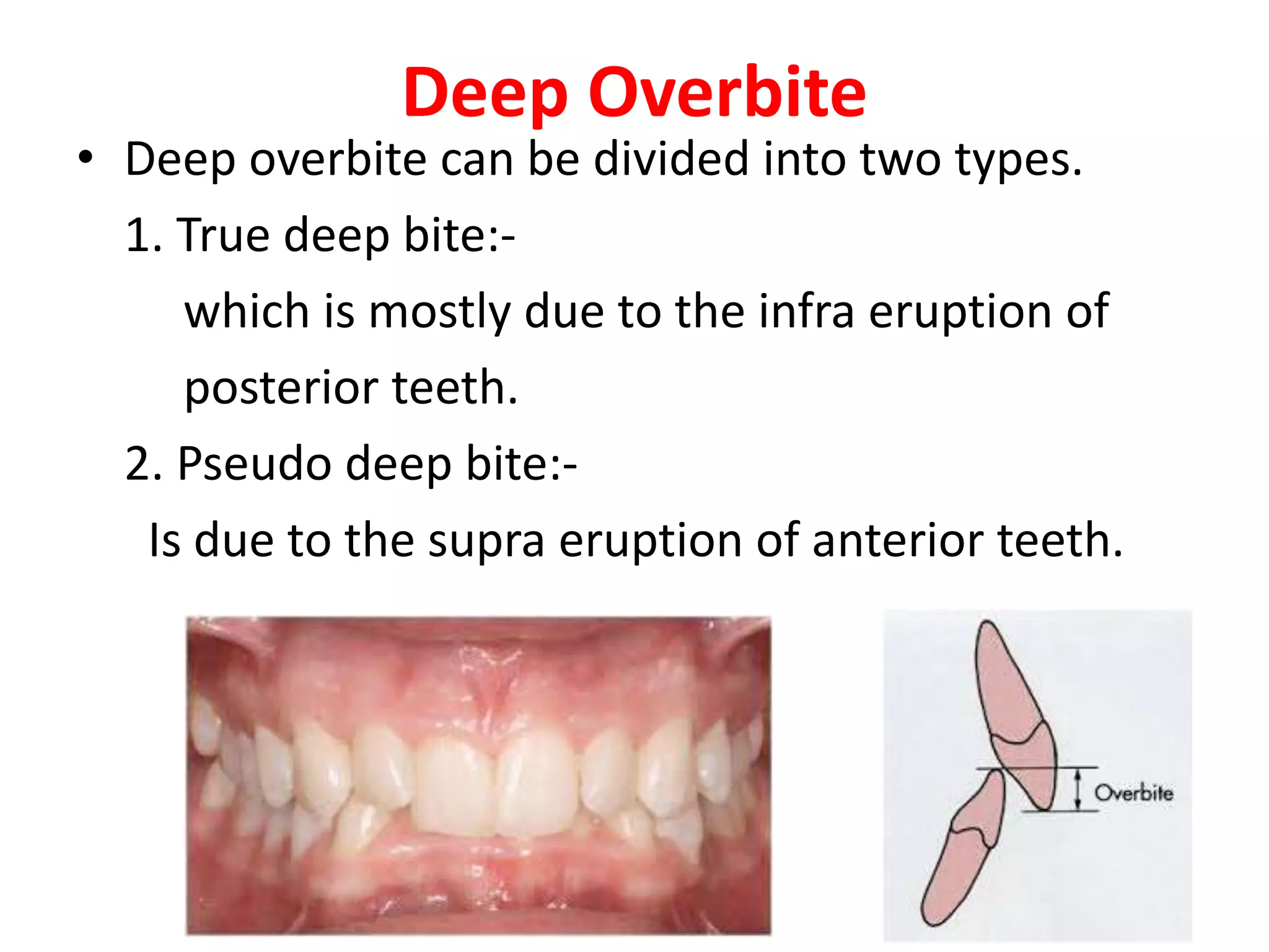 Alignment and leveling | PPTX