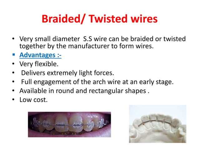Alignment and leveling | PPTX | Dental Health | Diseases and Conditions