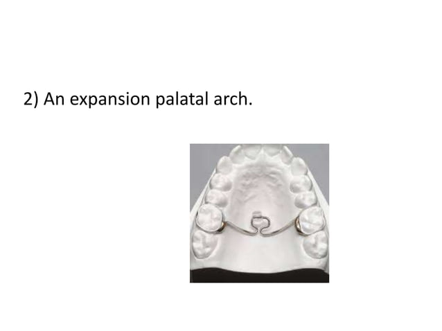 Alignment and leveling | PPTX | Dental Health | Diseases and Conditions