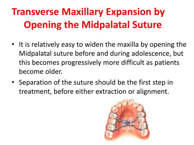 Alignment and leveling | PPTX | Dental Health | Diseases and Conditions
