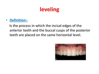 Alignment and leveling | PPTX