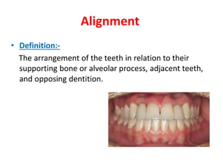 Alignment Definition