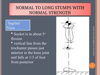 Alignment of Transfemoral prosthesis, TF | PPT