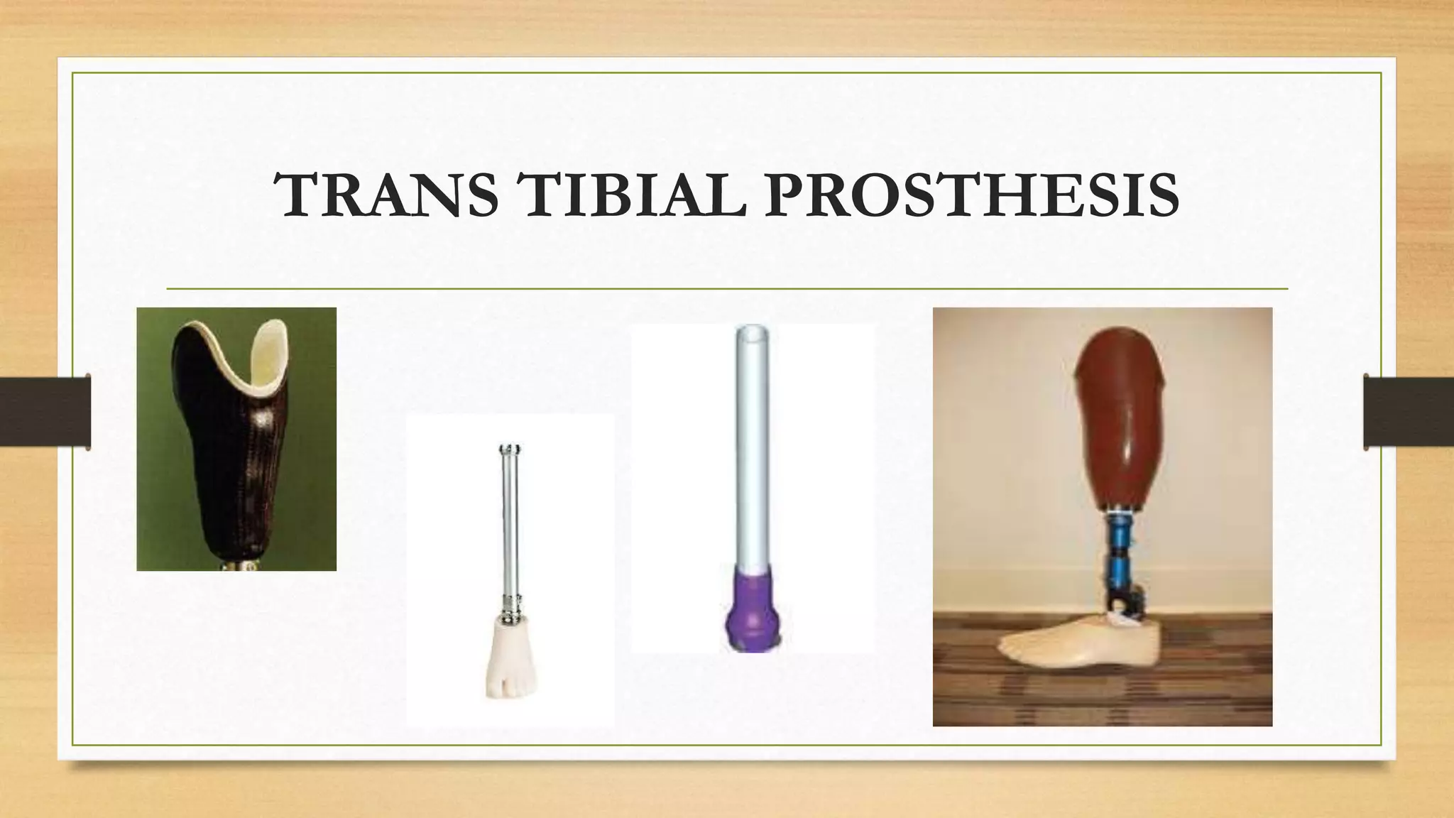 Alignment of Trans Tibial Prosthesis | PPTX