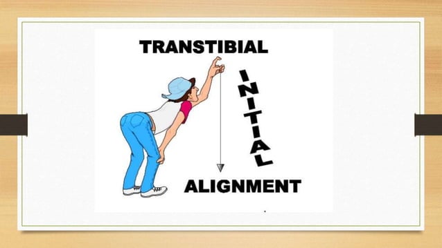 Alignment of Trans Tibial Prosthesis | PPTX