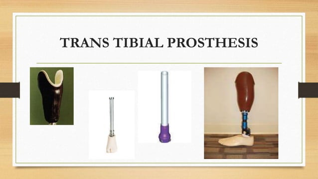 Alignment of Trans Tibial Prosthesis | PPTX