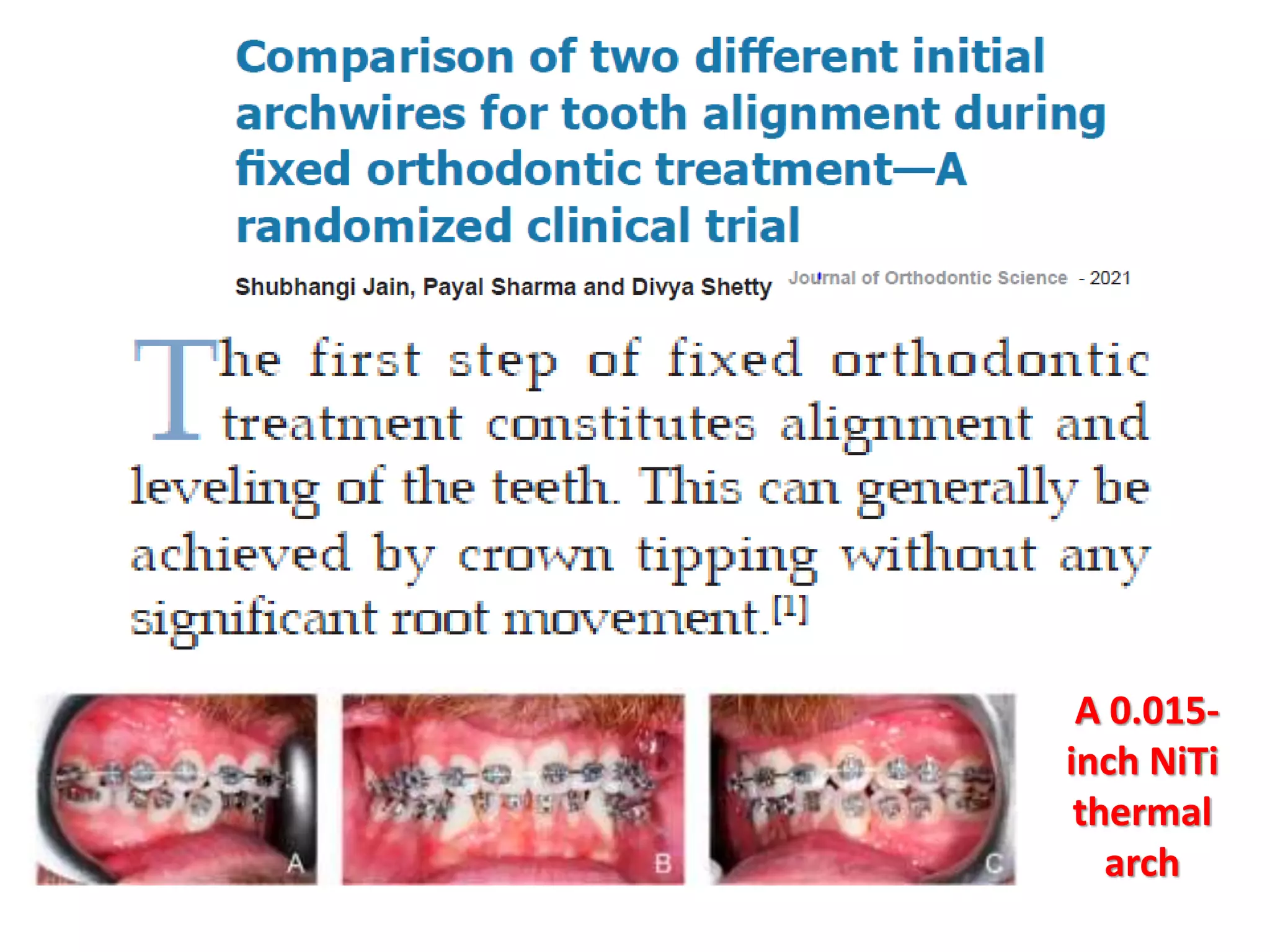 orthodontic alignment of teeth part 3 | PPTX
