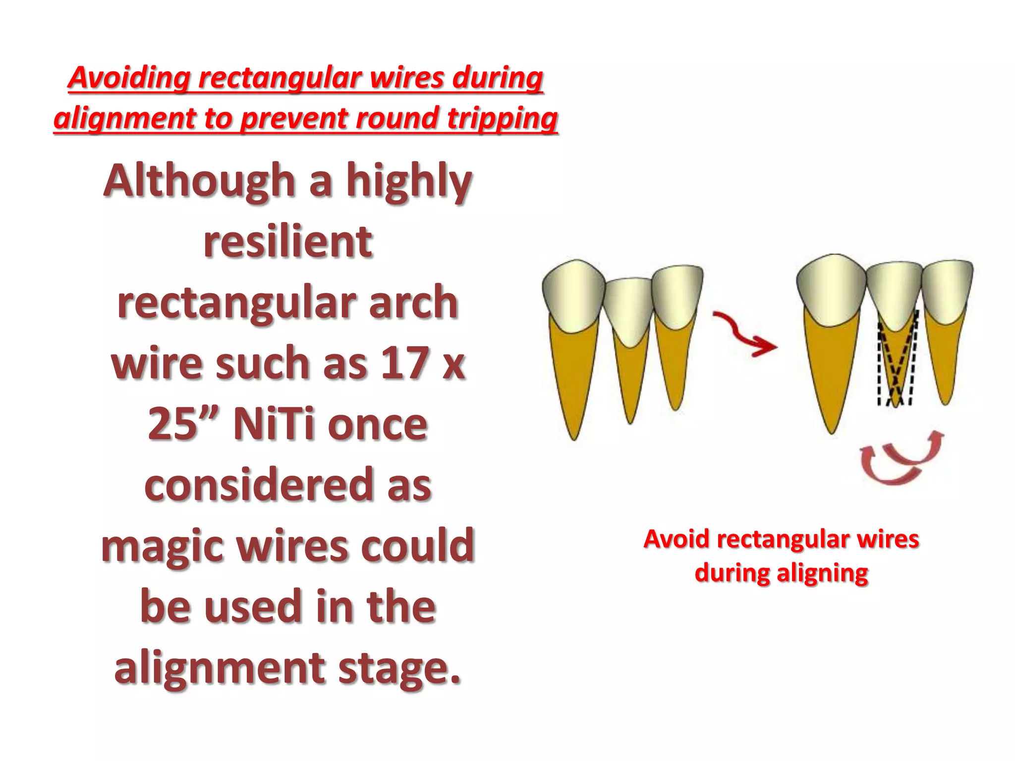 orthodontic alignment of teeth part 3 | PPTX