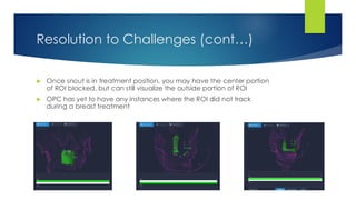 AlignRT for Proton Therapy Breast Treatments | PDF
