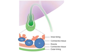 Alimentary tract questions and answers for surgical residents. | PPT