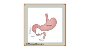 Alimentary system.pptx
