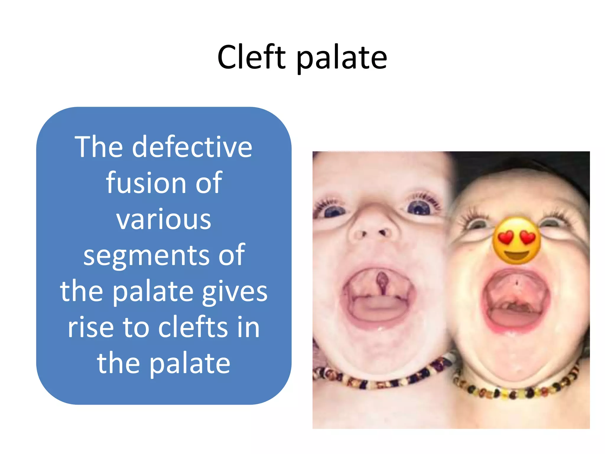 Alimentary tract (clinical anatomy) | PPT