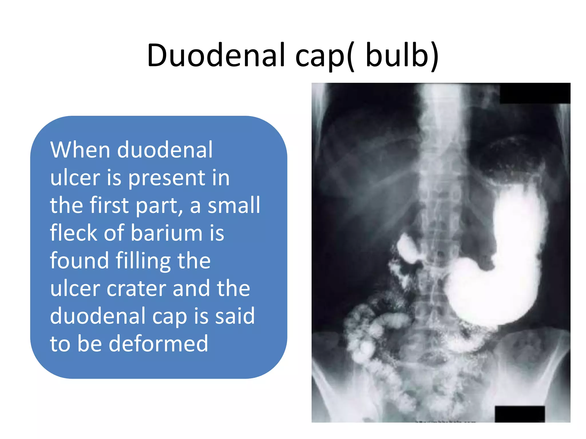 Alimentary tract (clinical anatomy) | PPT