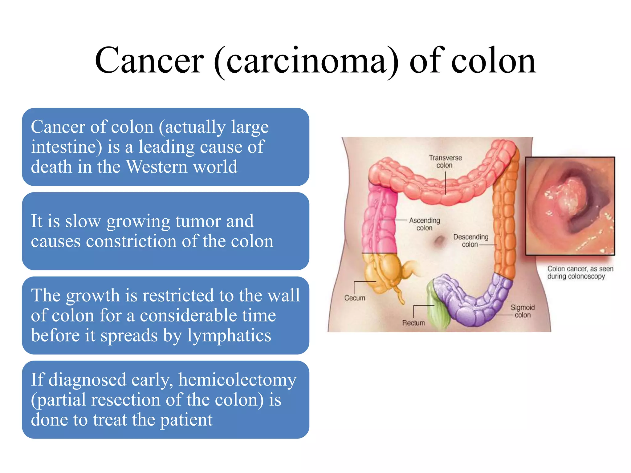 Alimentary tract (clinical anatomy) | PPT