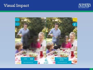 Alimera Sciences | PDF