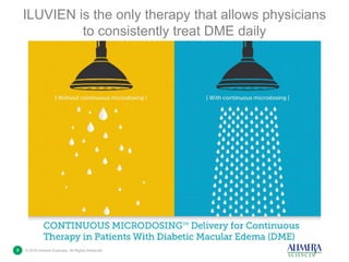 Posterior Segment Company Showcase - Alimera Sciences | PPT