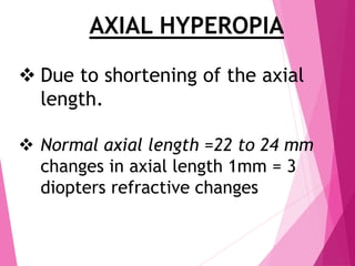 Alimullah (Hypermetropia) (1).pptx | Eye and Vision Conditions ...