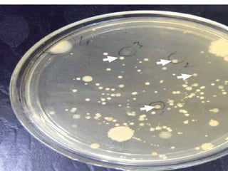 ali rasool listeria.pptxfemkmnkenkndkendcn | PPTX