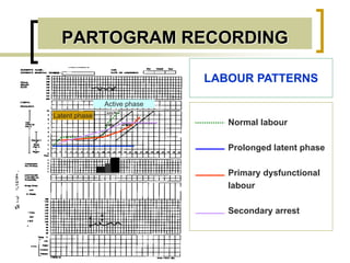 Ali Salam pathogram.pptx pathgram all details during tha labor | PPT