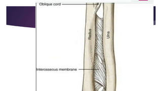 Upper limb LIGAMENTS.pptx | Free Download