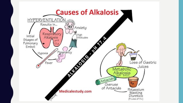 Alkalosis | PPT