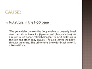 Alkaptonuria | PPTX