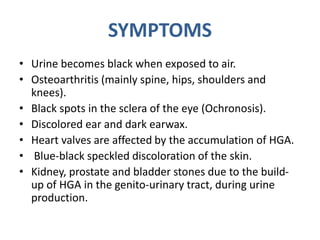 Alkaptonuria | PPTX