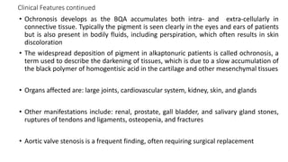 Alkaptonuria | PPT