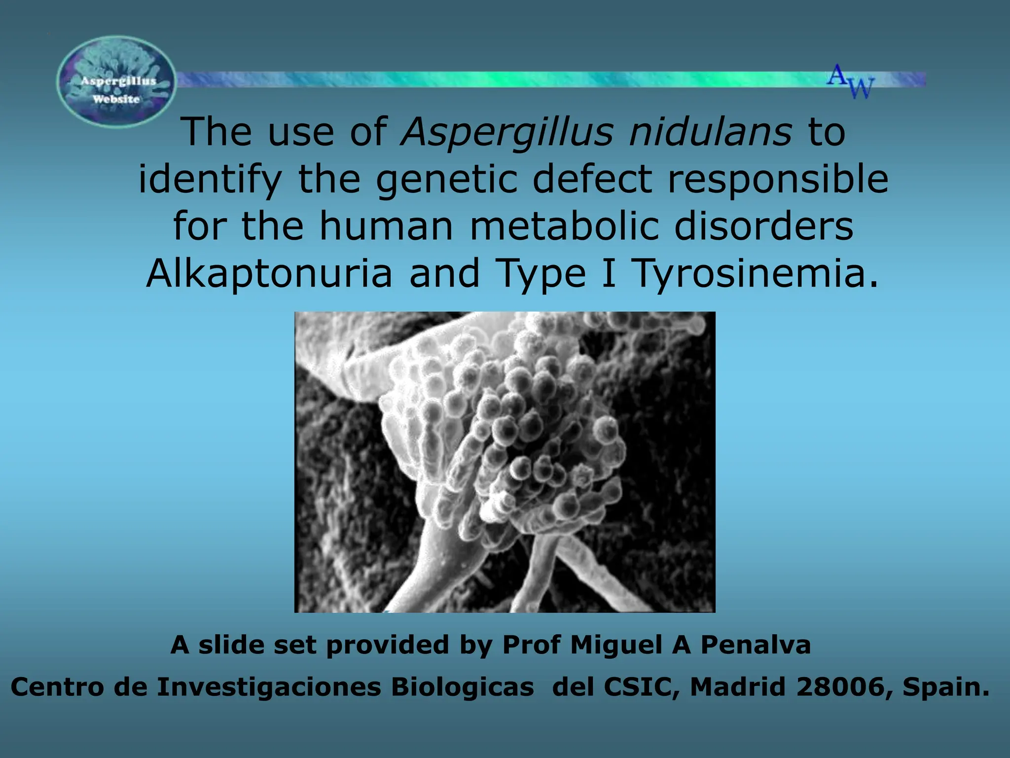 alkaptonuria a rare disease also called as black urine disease | PPT