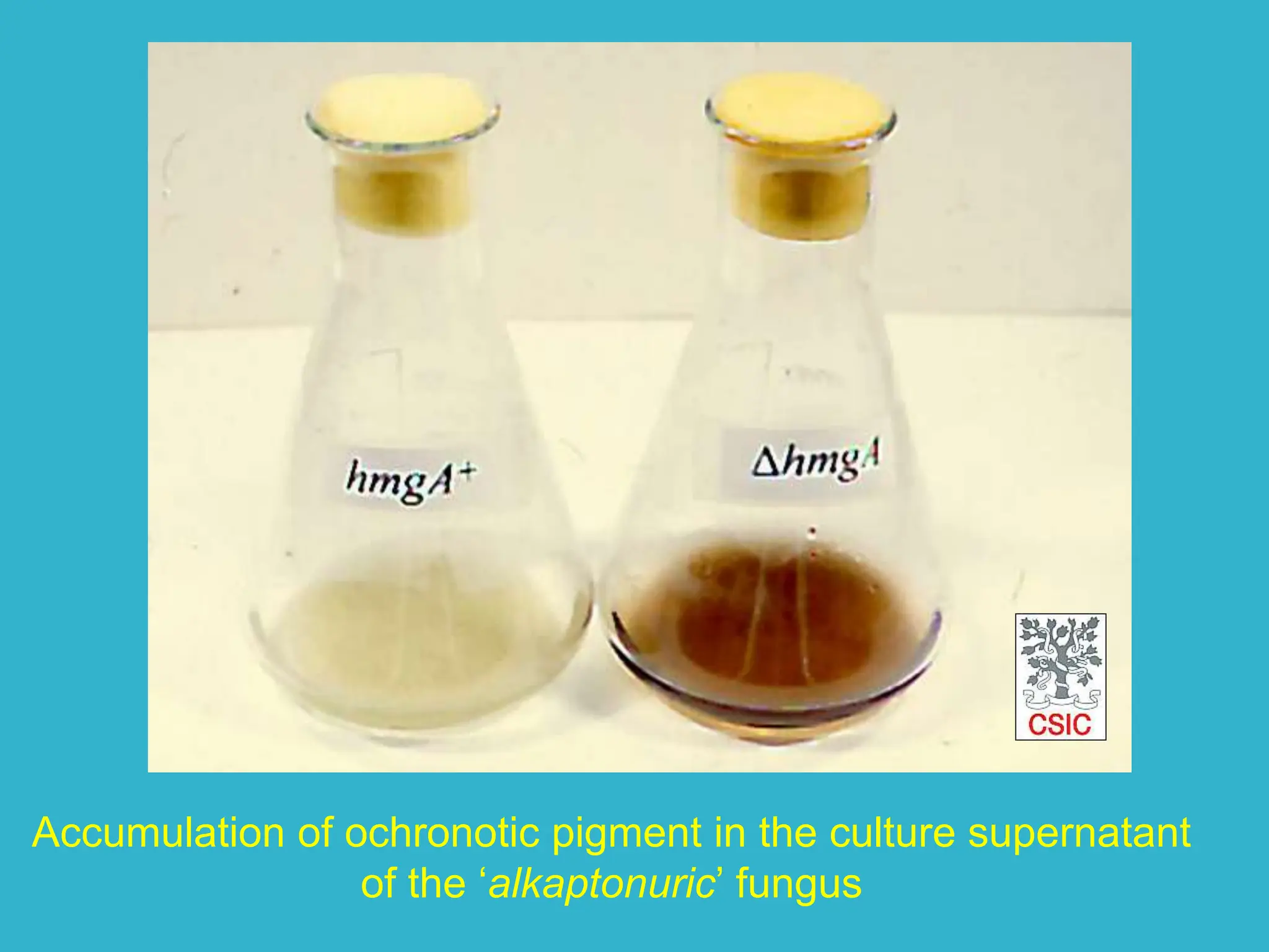 alkaptonuria a rare disease also called as black urine disease | PPT
