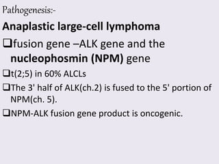 Alk positive lymphoma | PPTX