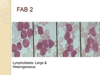Acute lymphoblastic leukemia approach and treatment | PPTX