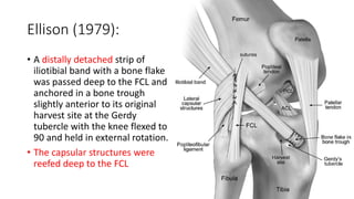 ALL (antero-lateral ligament) - extra articular ACL reconstruction ...