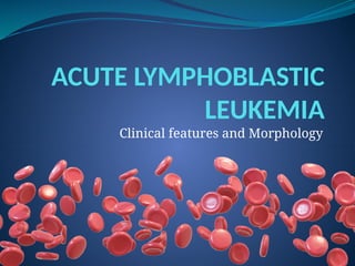 A presentation on Pathology acute lymphocytic leukemia | PPTX