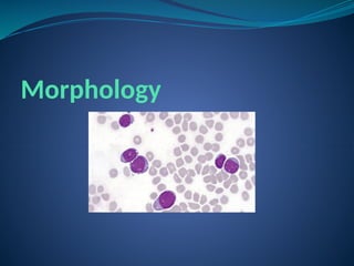 A presentation on Pathology acute lymphocytic leukemia | PPTX