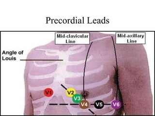 ECG easy way | PDF